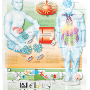 POLY LAMINATED BIOLOGICAL CHART, DIABETES, EACH